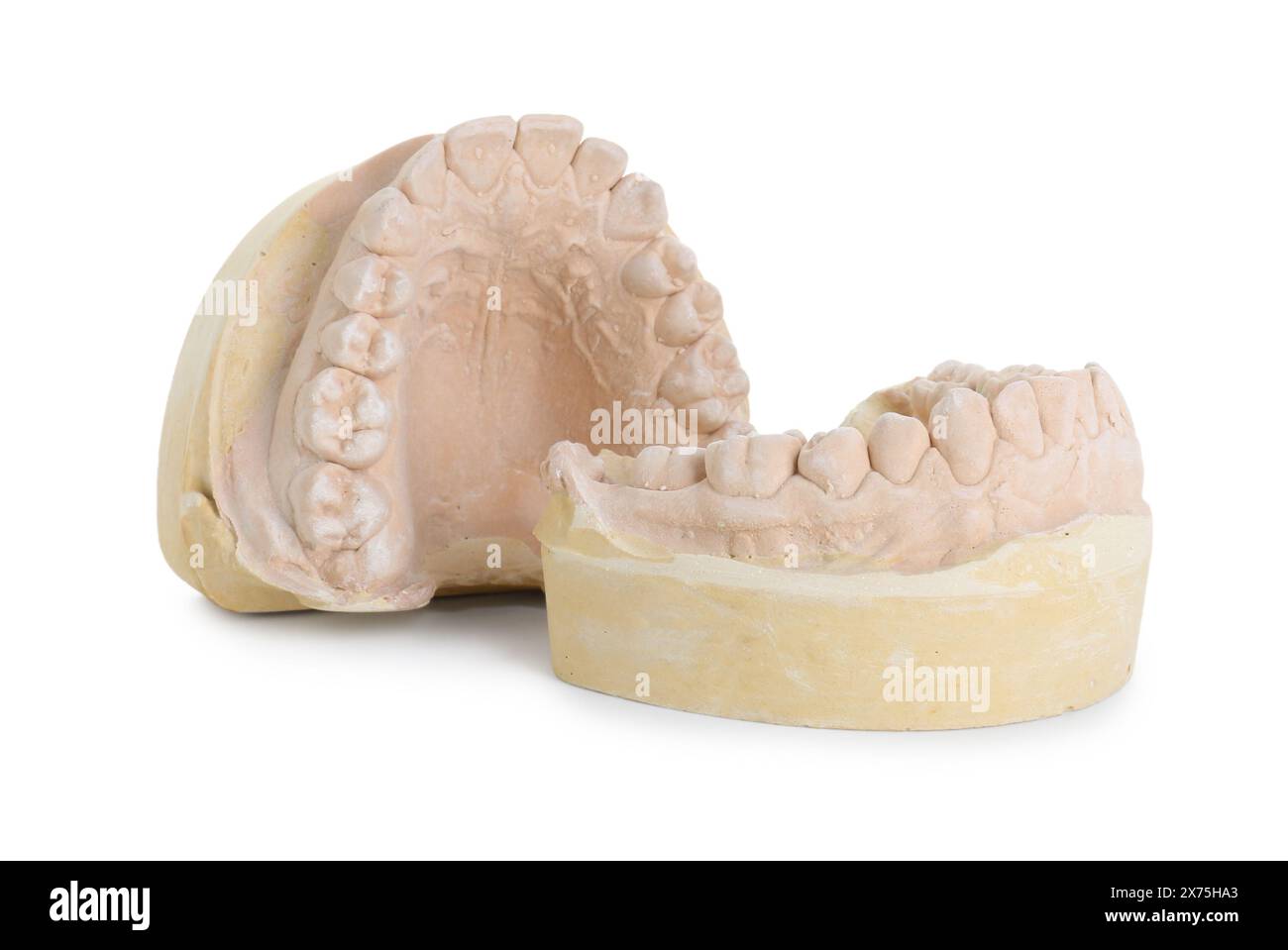 Dental model with jaws isolated on white. Cast of teeth Stock Photo - Alamy