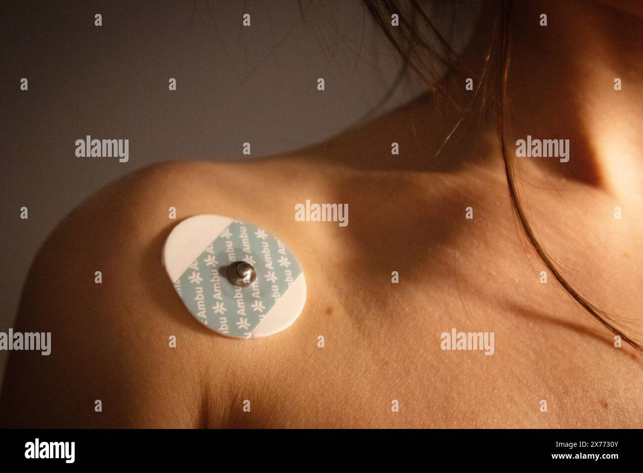 Madrid, Spain. 1 May 2024 Electrodes placed on female chest. Electro ...