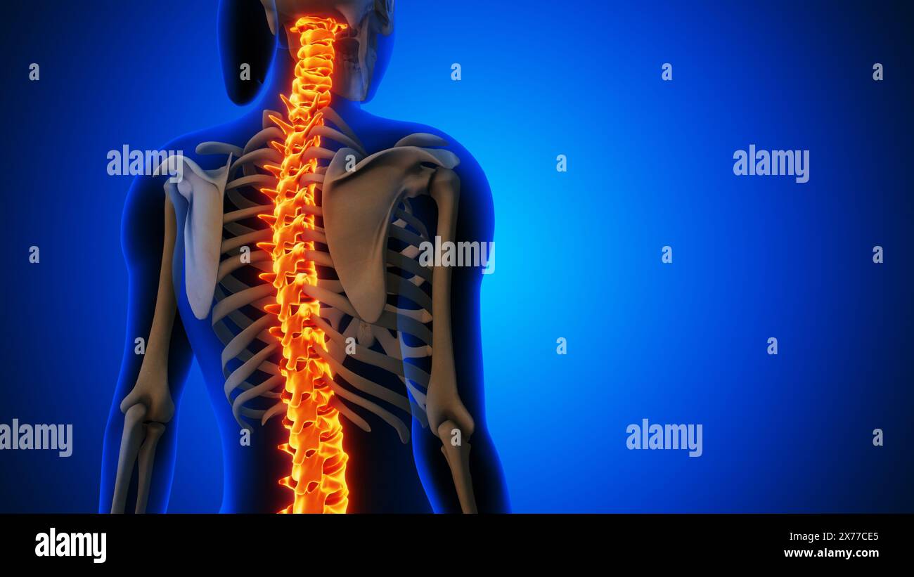 Female having a painful back medical background Stock Photo - Alamy