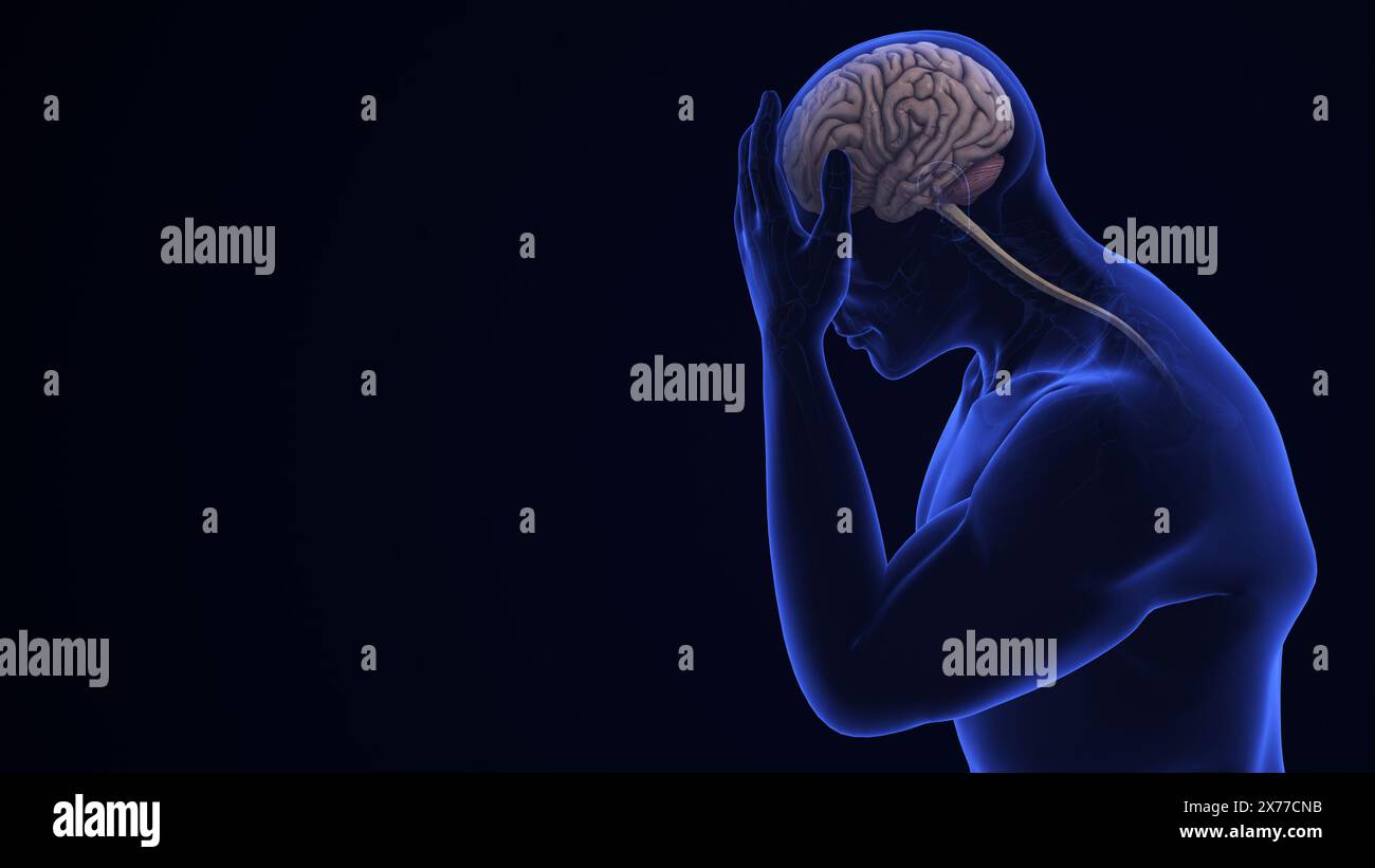 Human brain disease hi-res stock photography and images - Alamy