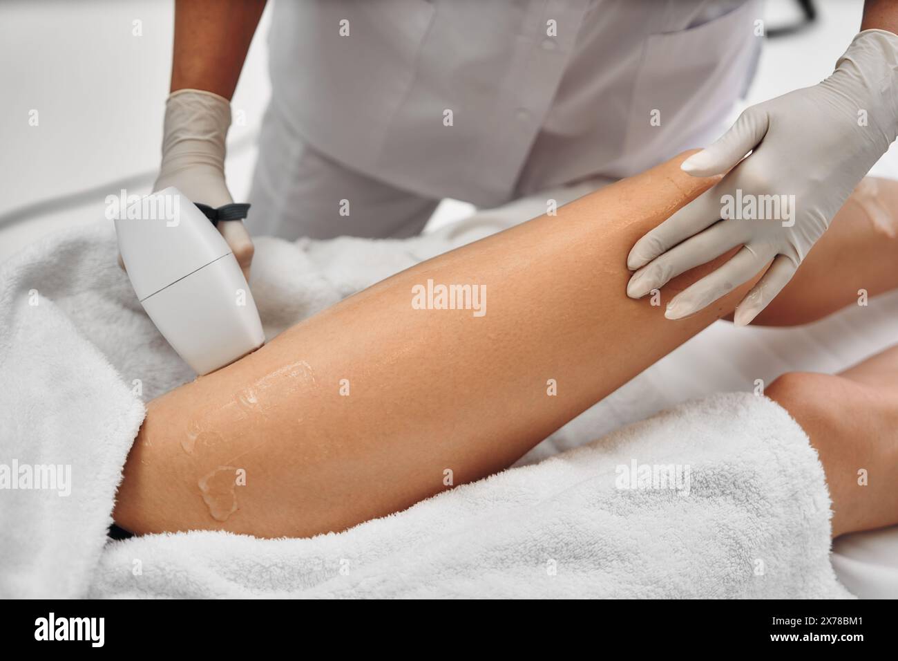 Laser epilation in bikini hi-res stock photography and images - Alamy