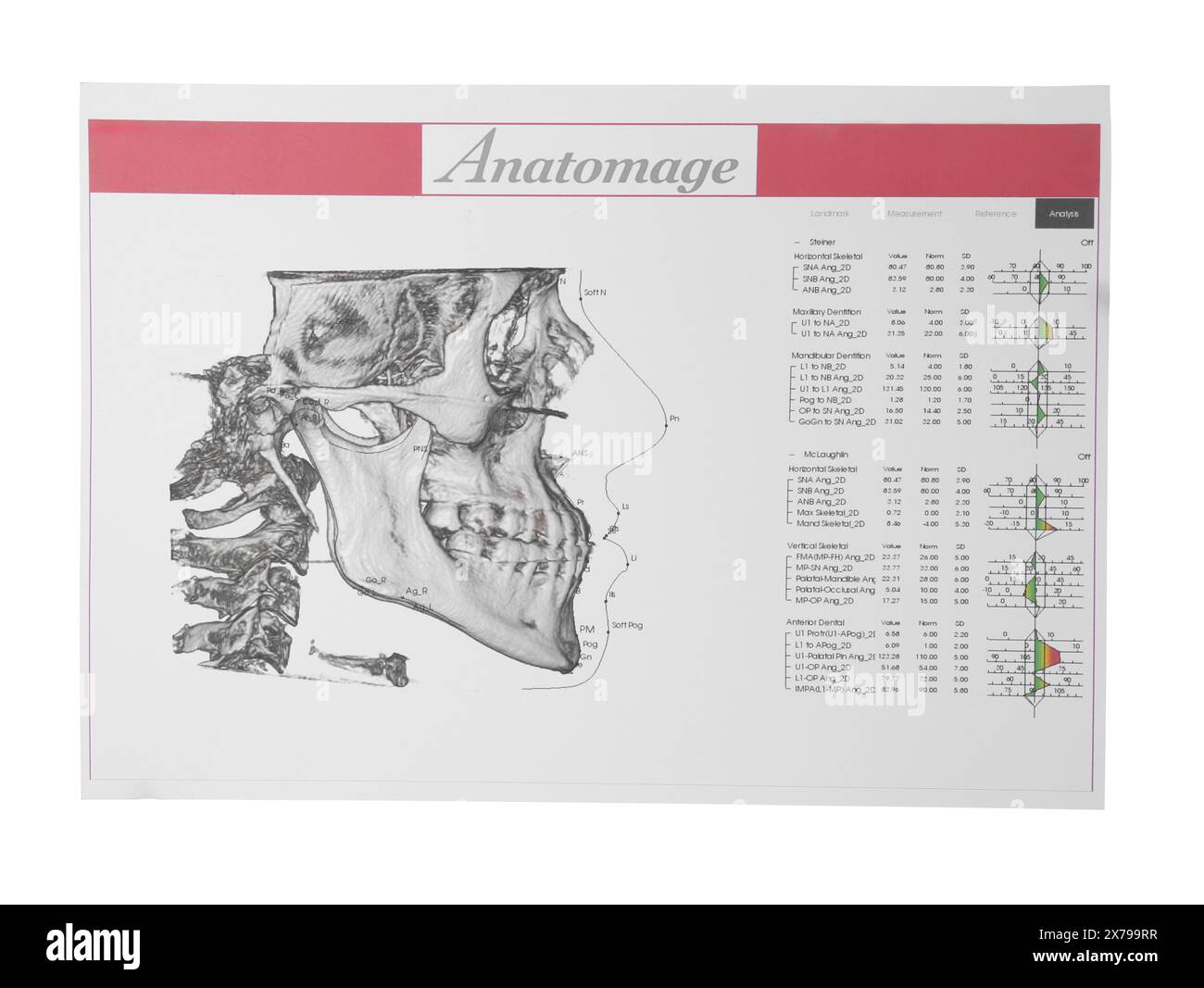 Visualization of human maxillofacial section for dental analysis ...