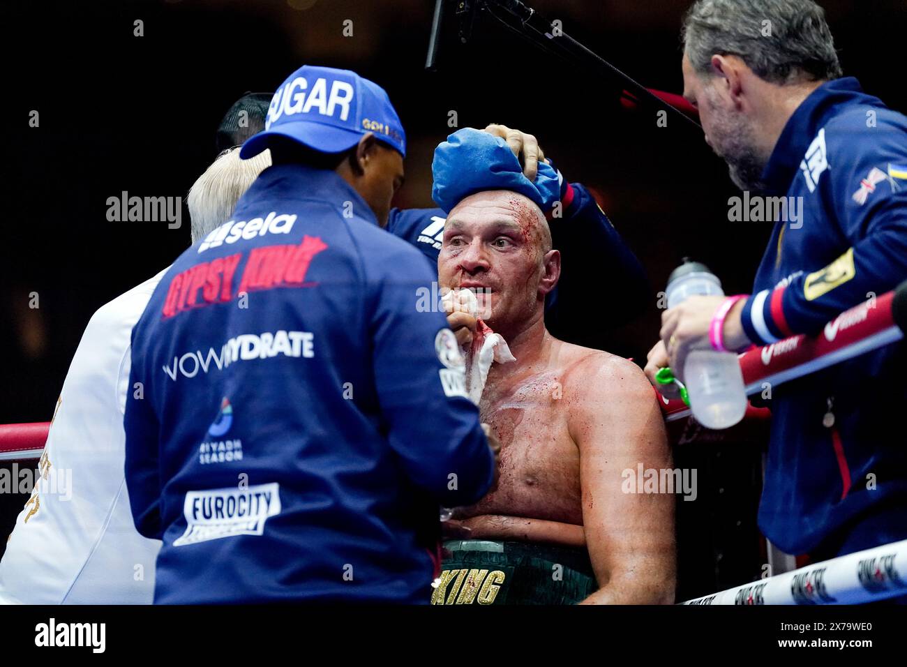 Tyson Fury receives treatment after being cut in the Heavyweight ...