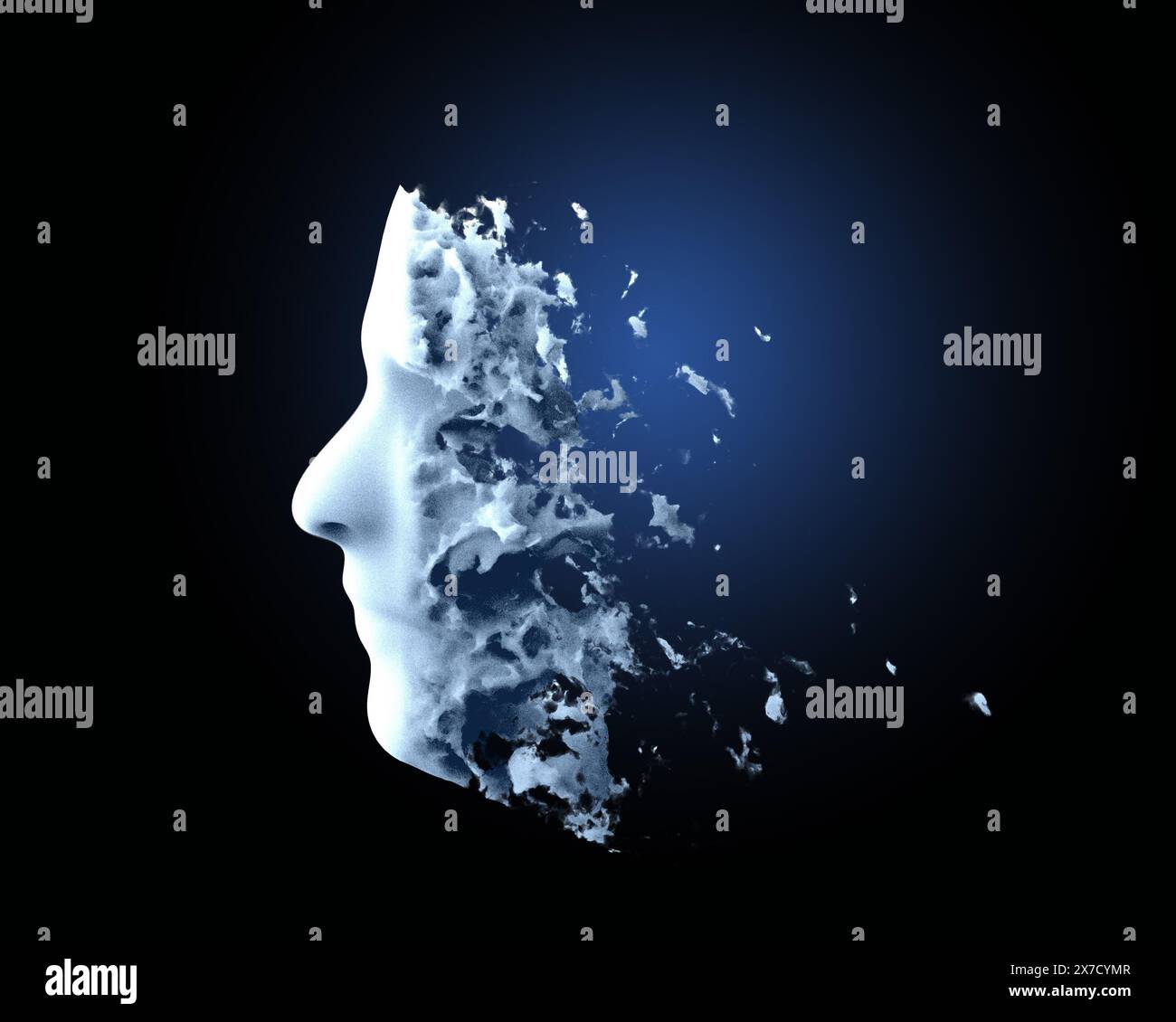 Face seen from the side. Degenerative disease. Brain degenerative ...