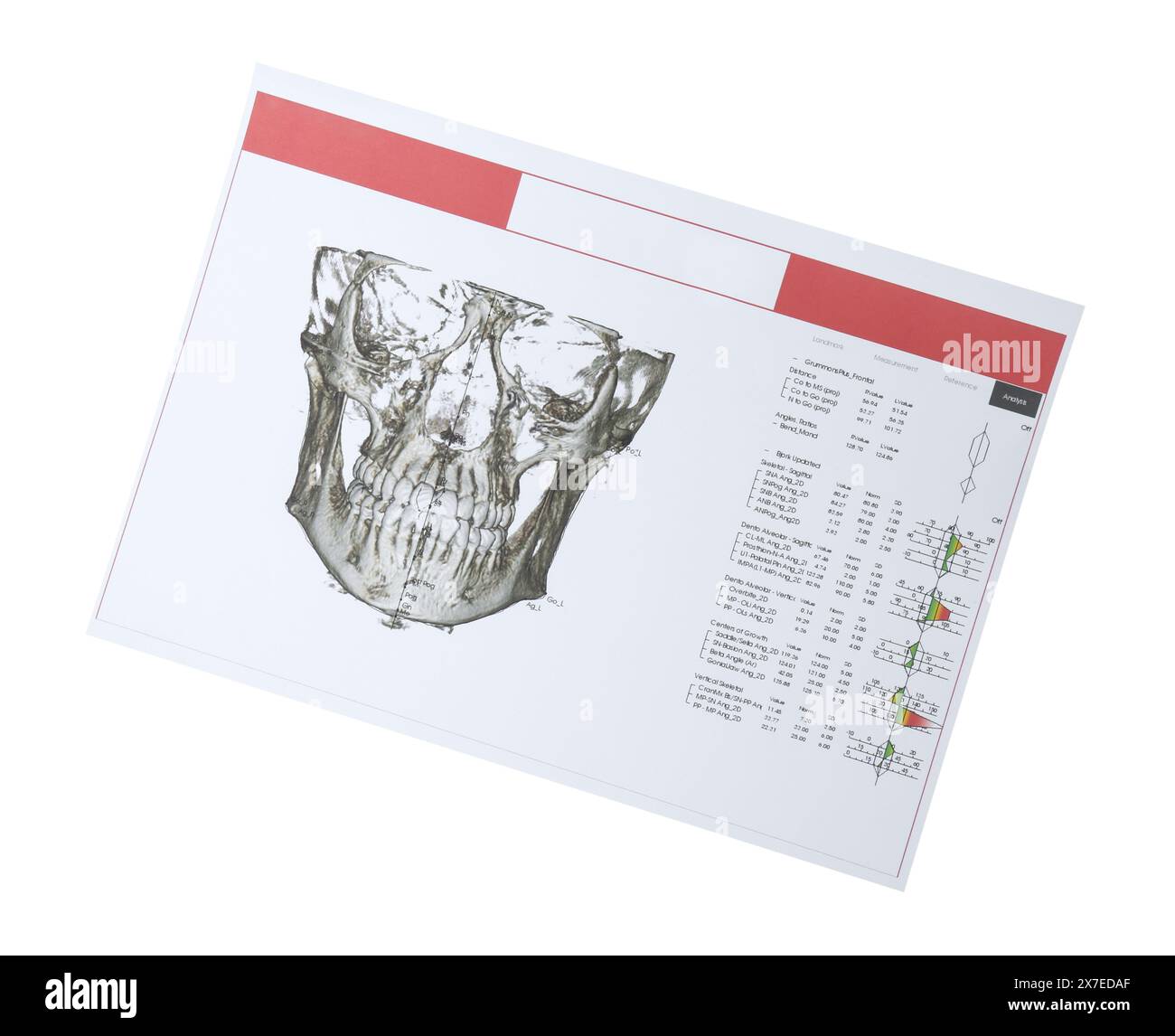 Visualization of human maxillofacial section for dental analysis ...