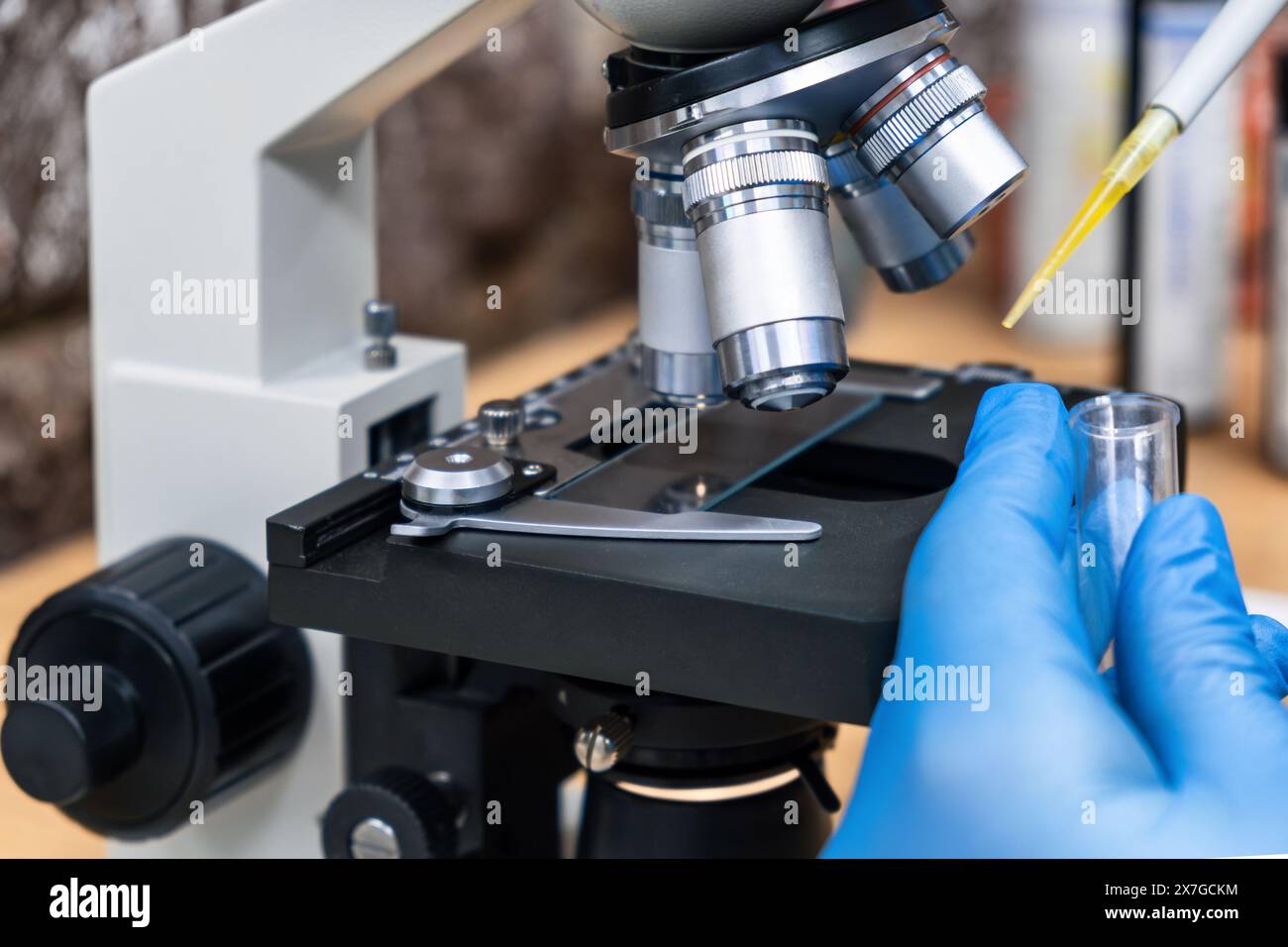 Doctor dripping urine from a pipette onto glass under microscope to ...