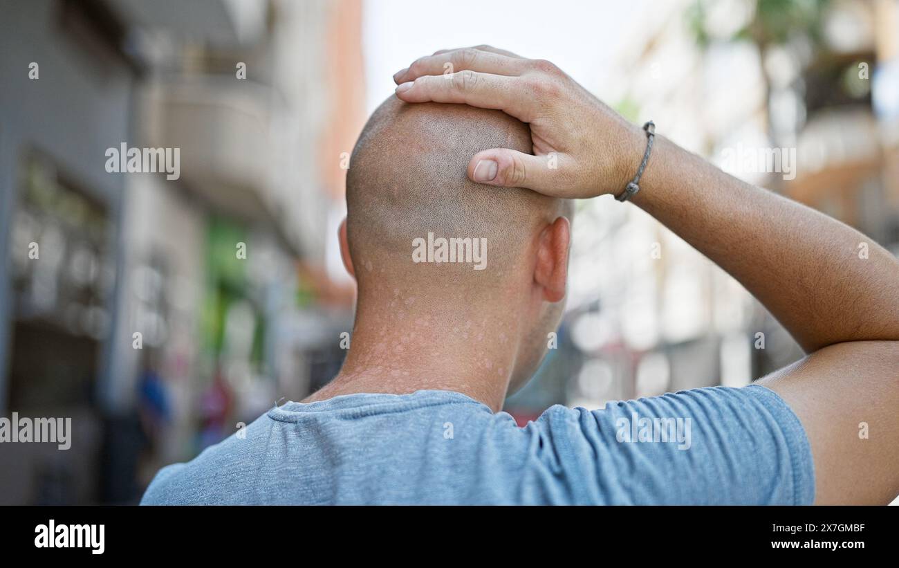 Young hispanic man standing backwards touching head at street Stock ...