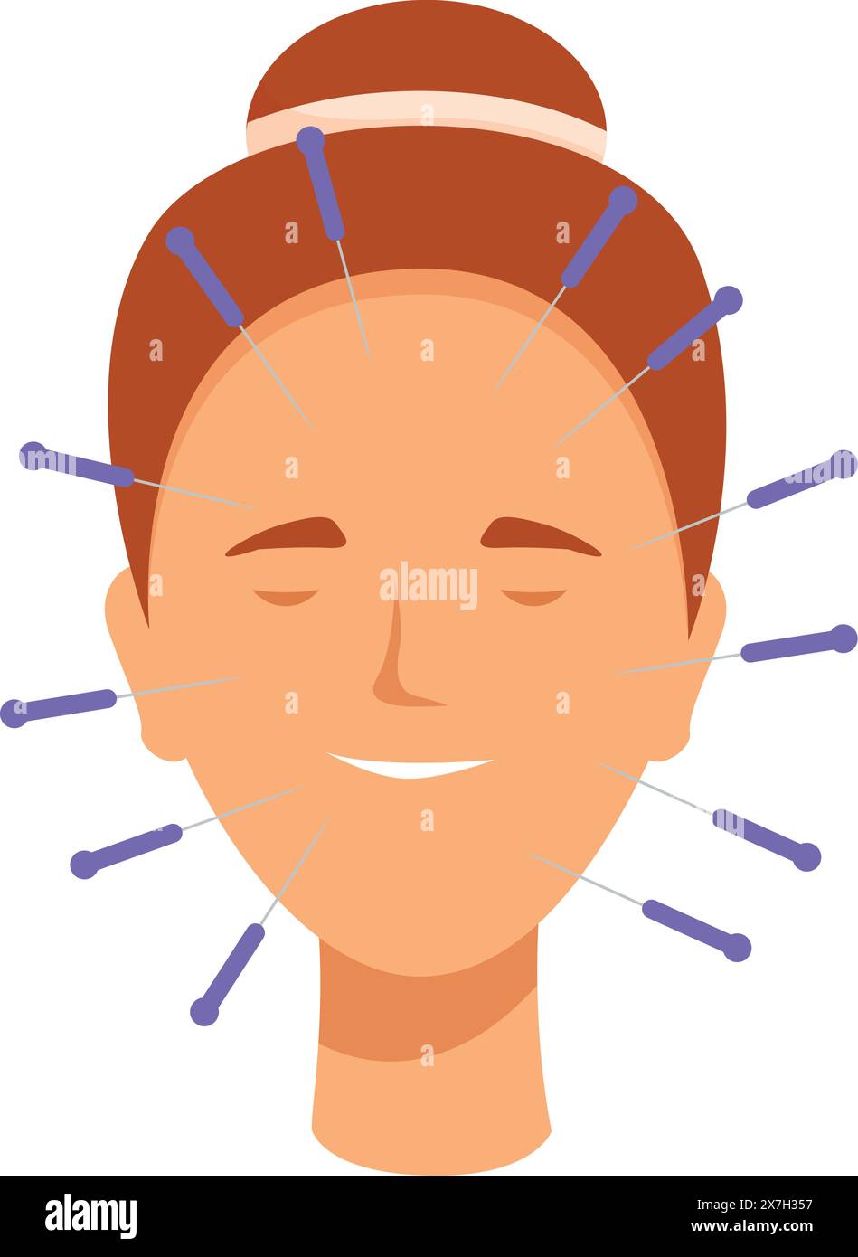 Woman receiving acupuncture Stock Vector Images - Alamy