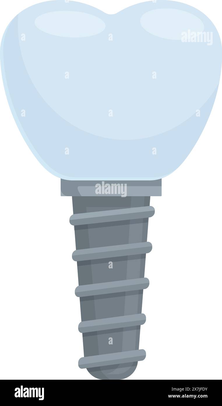 Detailed dental implant illustration for prosthetic tooth replacement ...