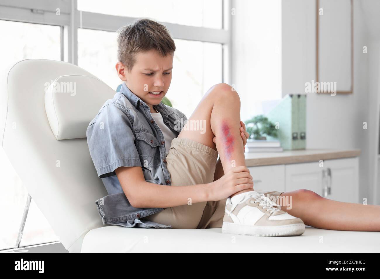 Little boy with bruised leg sitting on couch in clinic Stock Photo - Alamy
