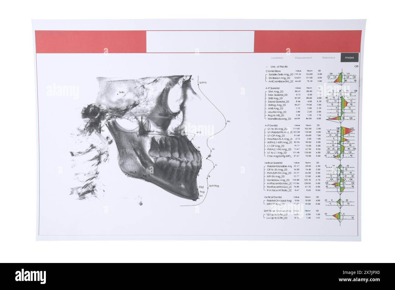Visualization of human maxillofacial section for dental analysis ...