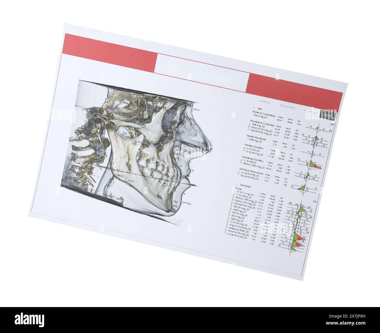 Visualization of human maxillofacial section for dental analysis ...