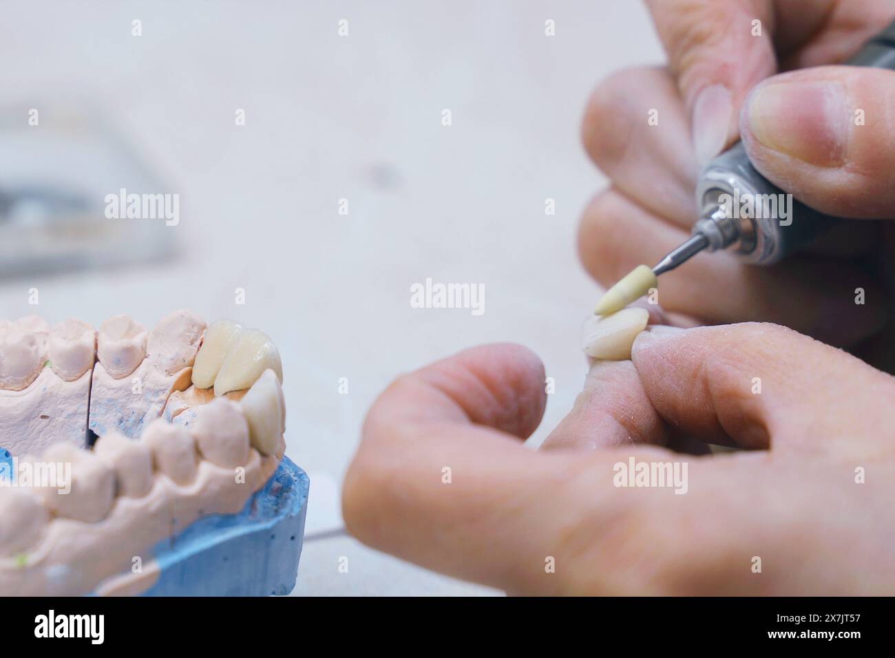 Denture making hi-res stock photography and images - Alamy