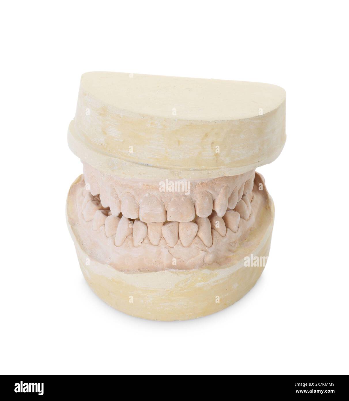 Dental model with jaws isolated on white. Cast of teeth Stock Photo - Alamy