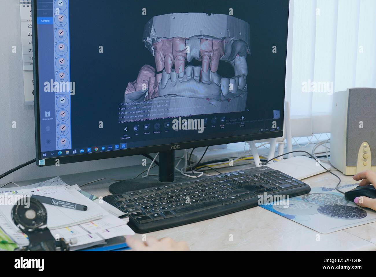 Program on computer display used by dental technician to make ...