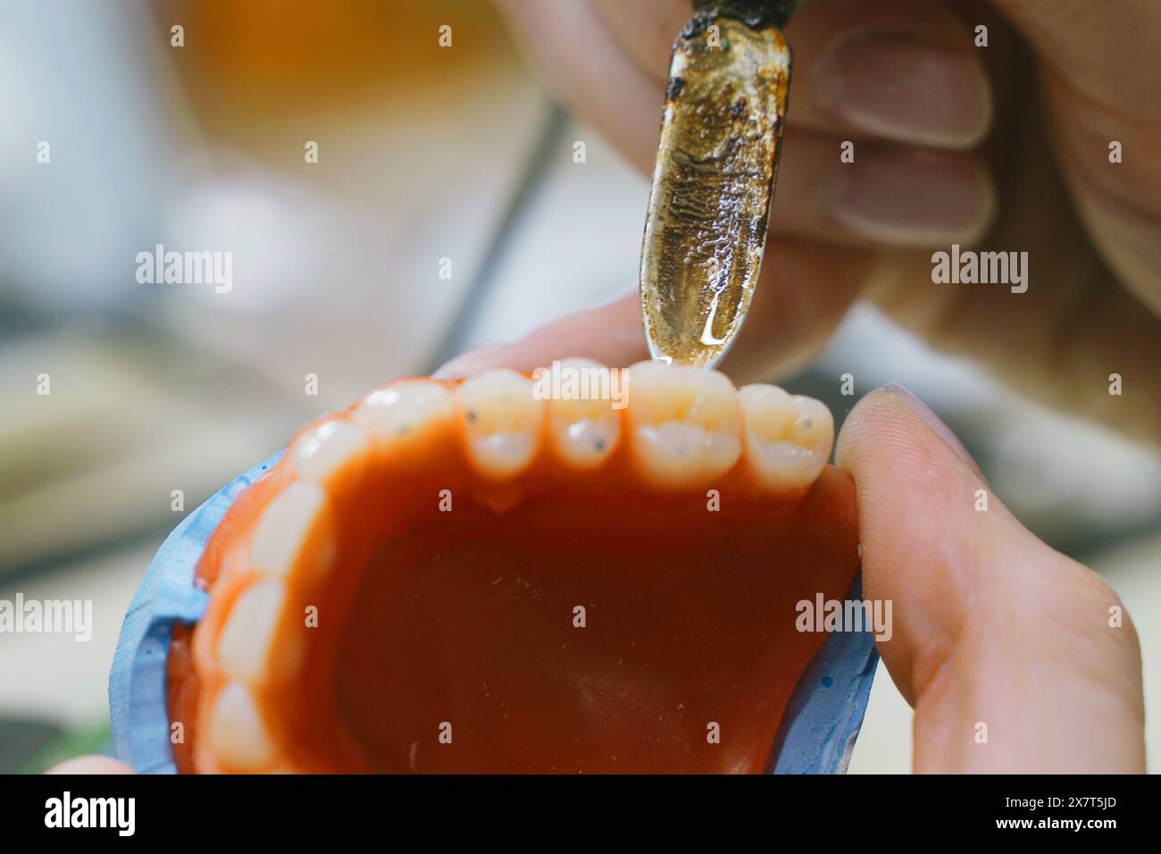 Forming dentures hi-res stock photography and images - Alamy
