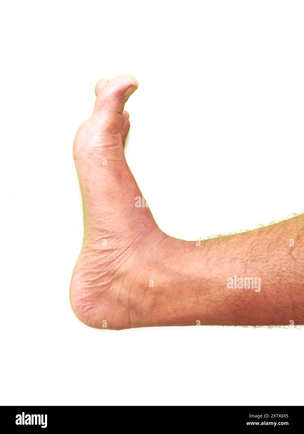 Human foot anatomy hi-res stock photography and images - Alamy