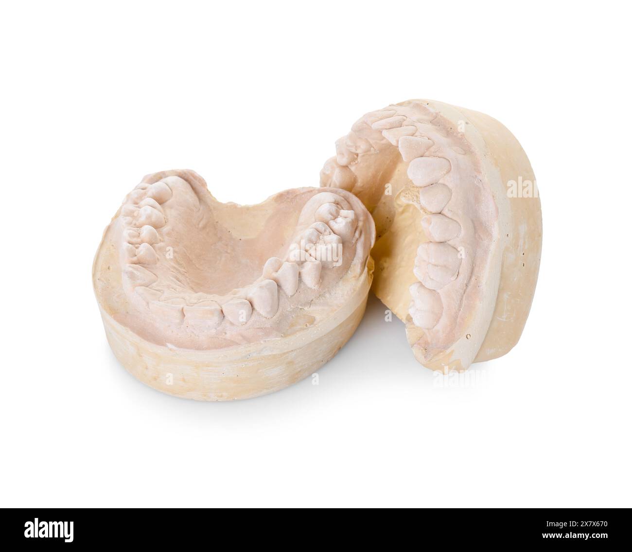Dental model with jaws isolated on white. Cast of teeth Stock Photo - Alamy