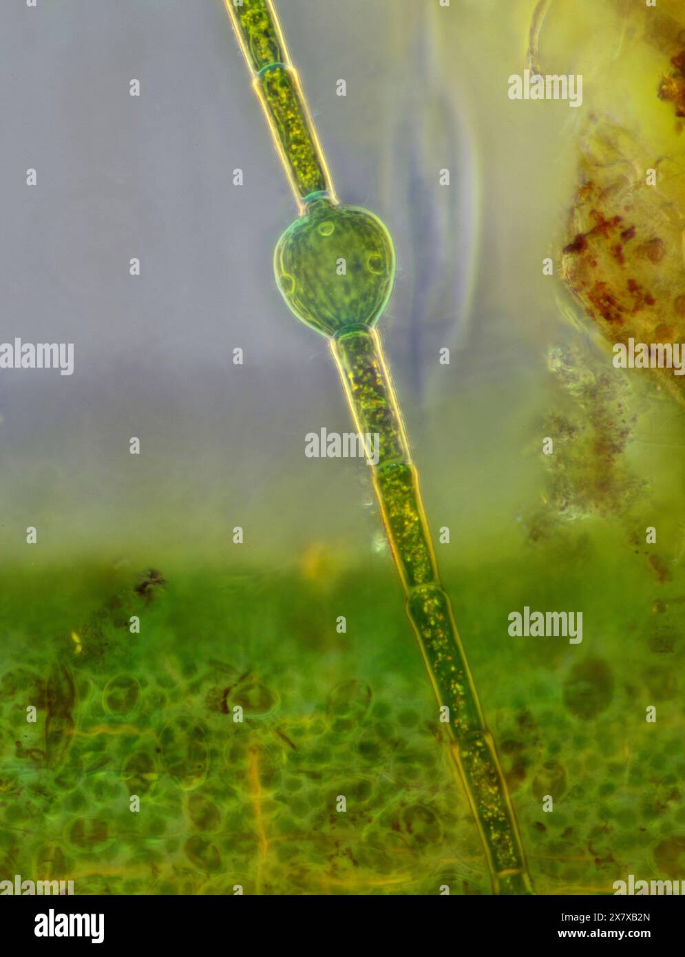 Polarised light micrograph of Oedogonium sp. filamentous green algae ...