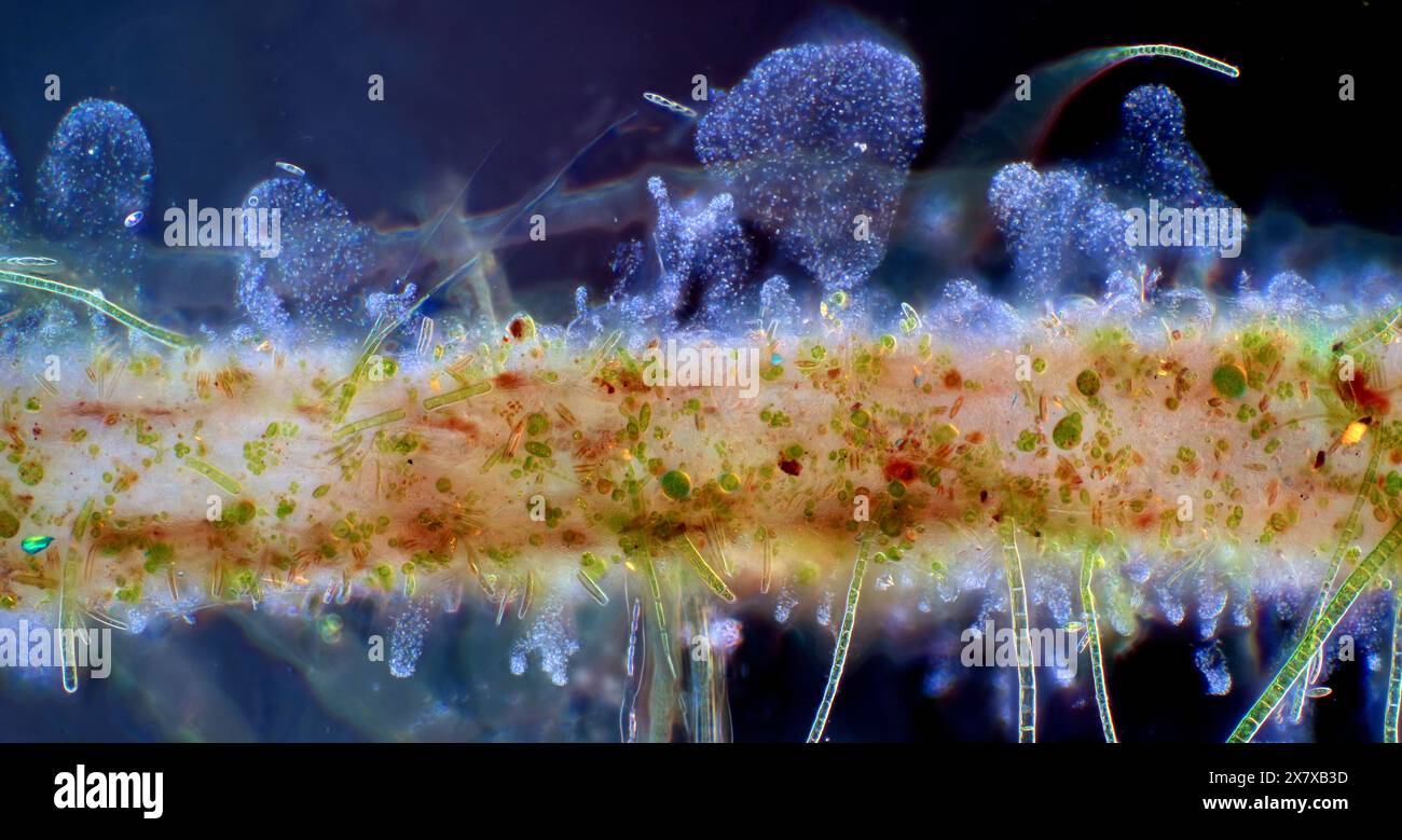 Polarised light micrograph of green algae and bacteria settled on ...