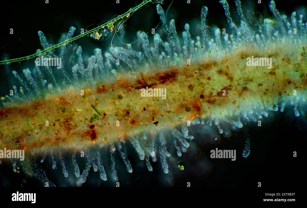 Polarised light micrograph of bacteria settled on duckweed (Lemna sp ...