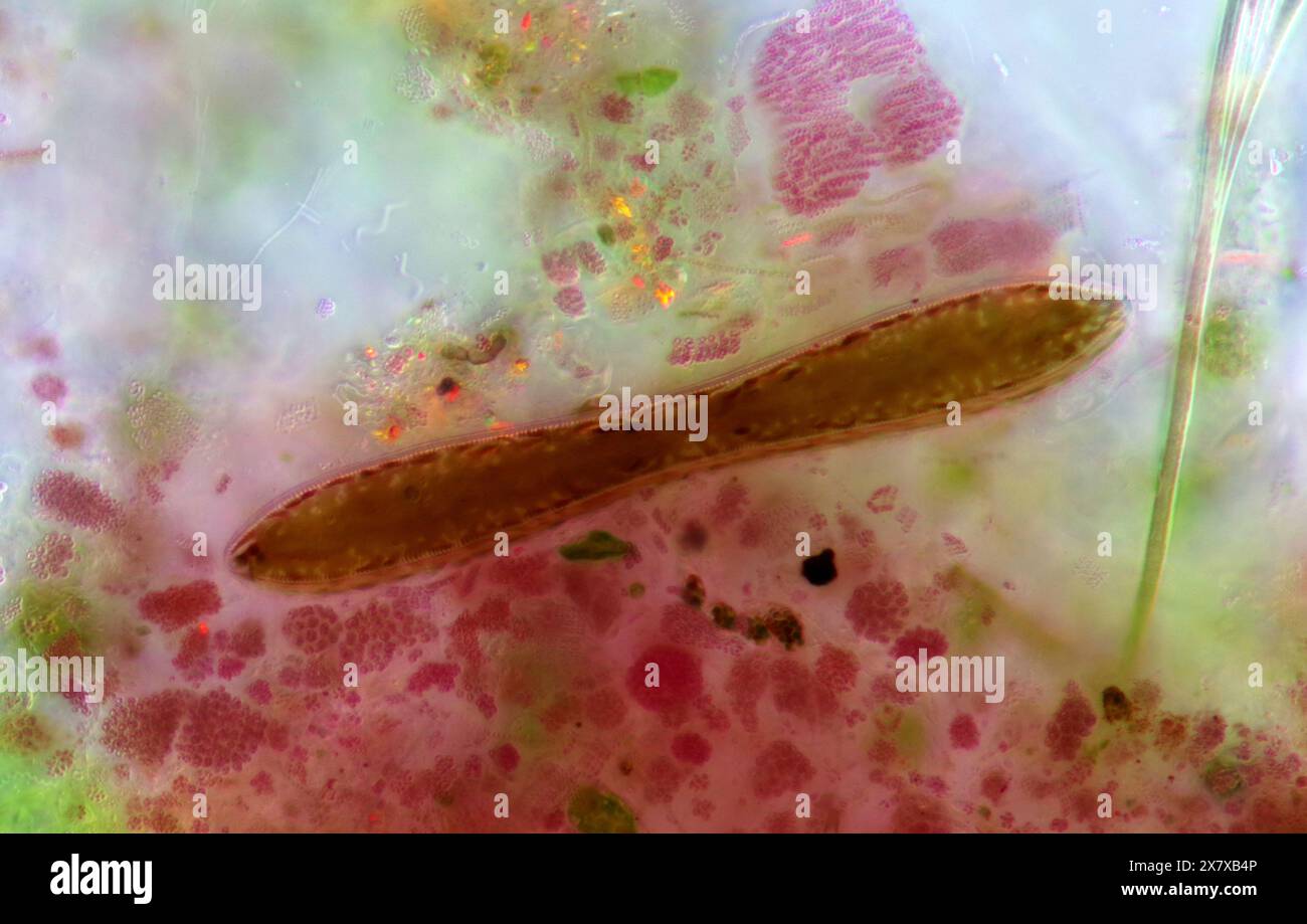 Polarised light micrograph of Surirella sp. diatom and purple bacteria ...