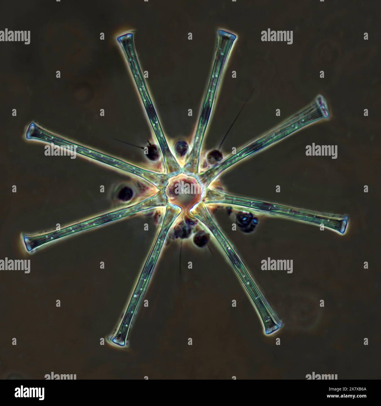 Phase contrast light micrograph of an Asterionella formosa (star-shaped ...
