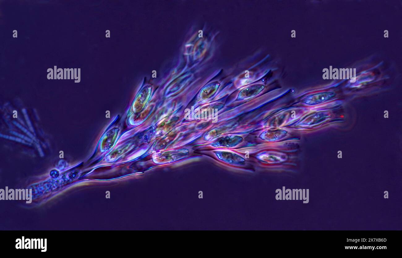 Polarised light micrograph of Dinobryon sp. algae. Dinobryon is a type ...
