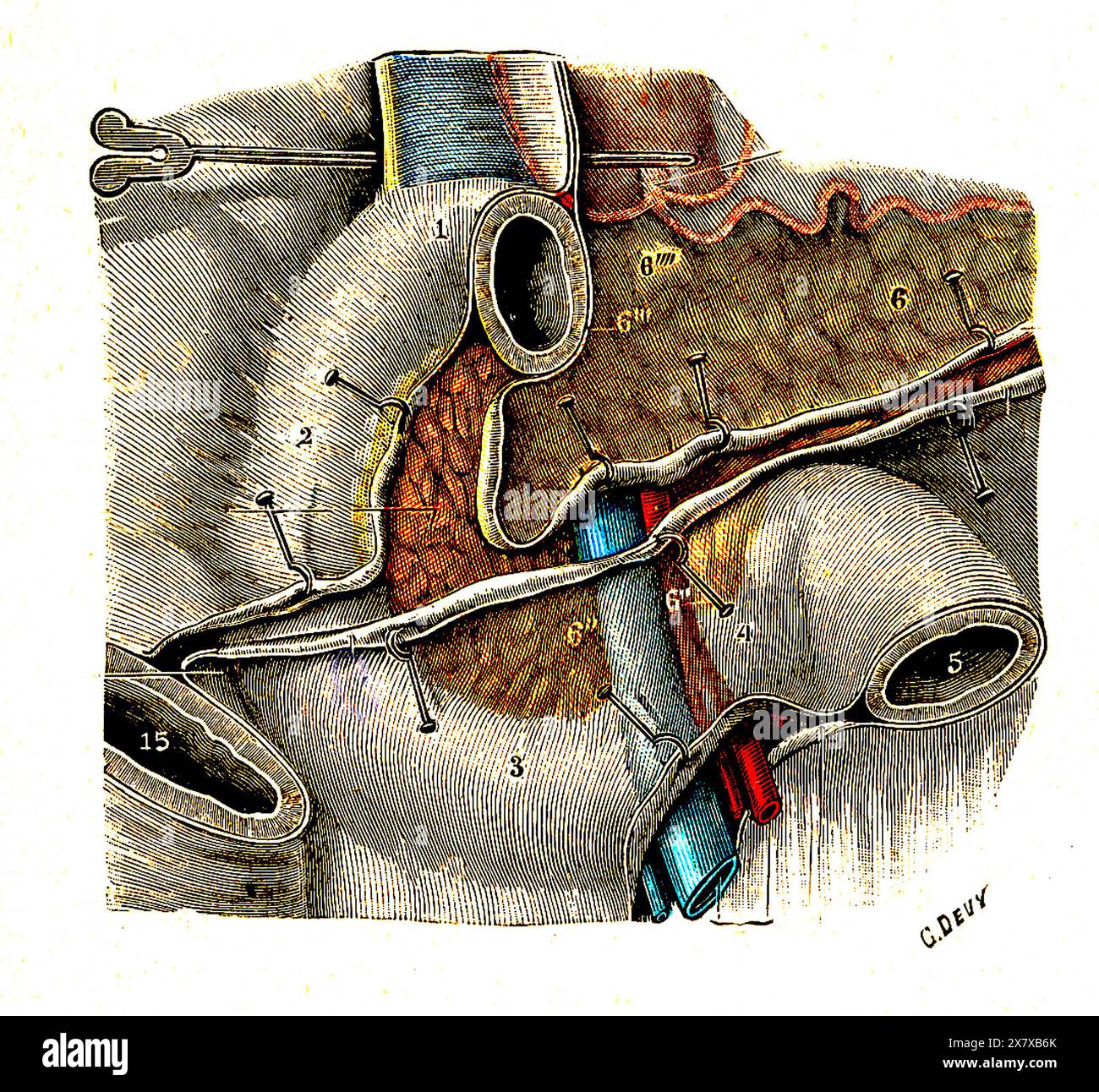 Illustration of the anatomy of the duodenum, the start of the small ...