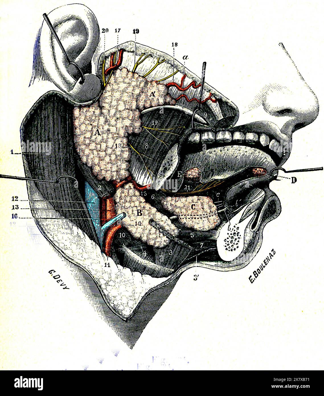 Cut-away illustration of the salivary glands. Beneath the ear is the ...
