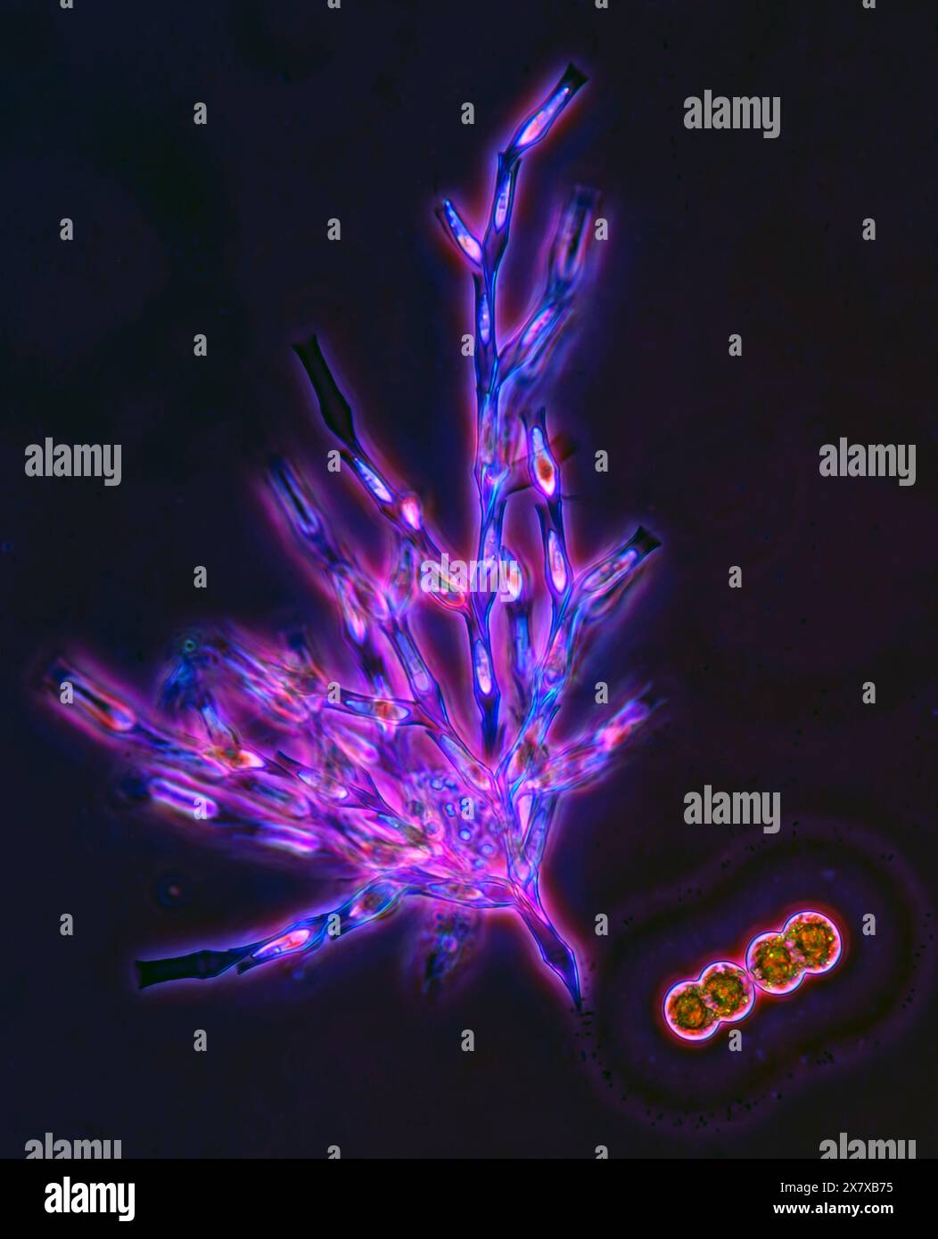 Polarised light micrograph of Dinobryon sp. and green algae. Dinobryon ...