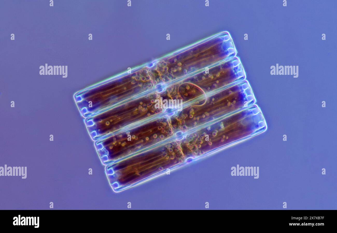 Polarised light micrograph of diatoms attached to each other after ...
