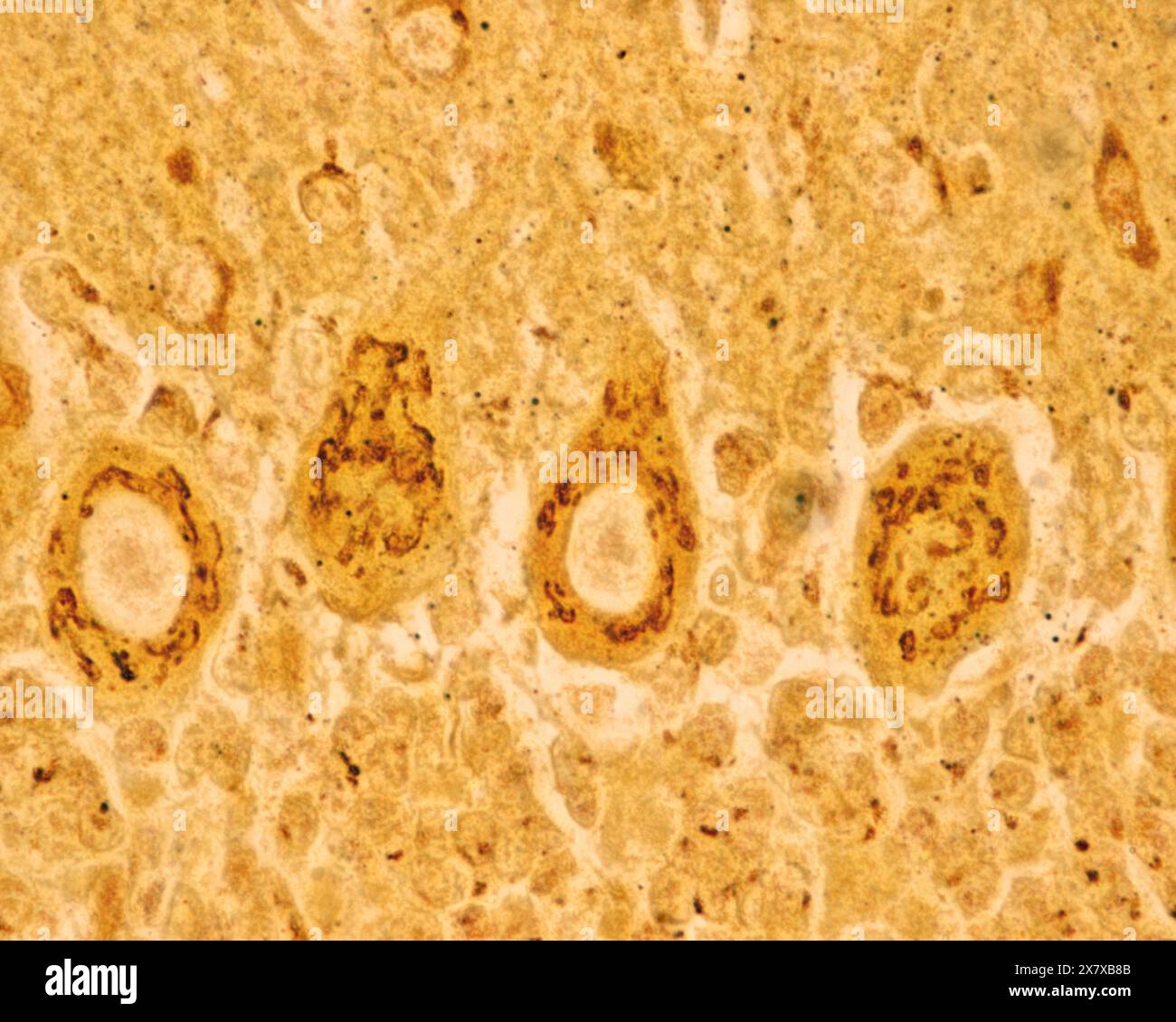 Cerebellar cortex. Light micrograph of Purkinje cells stained with ...