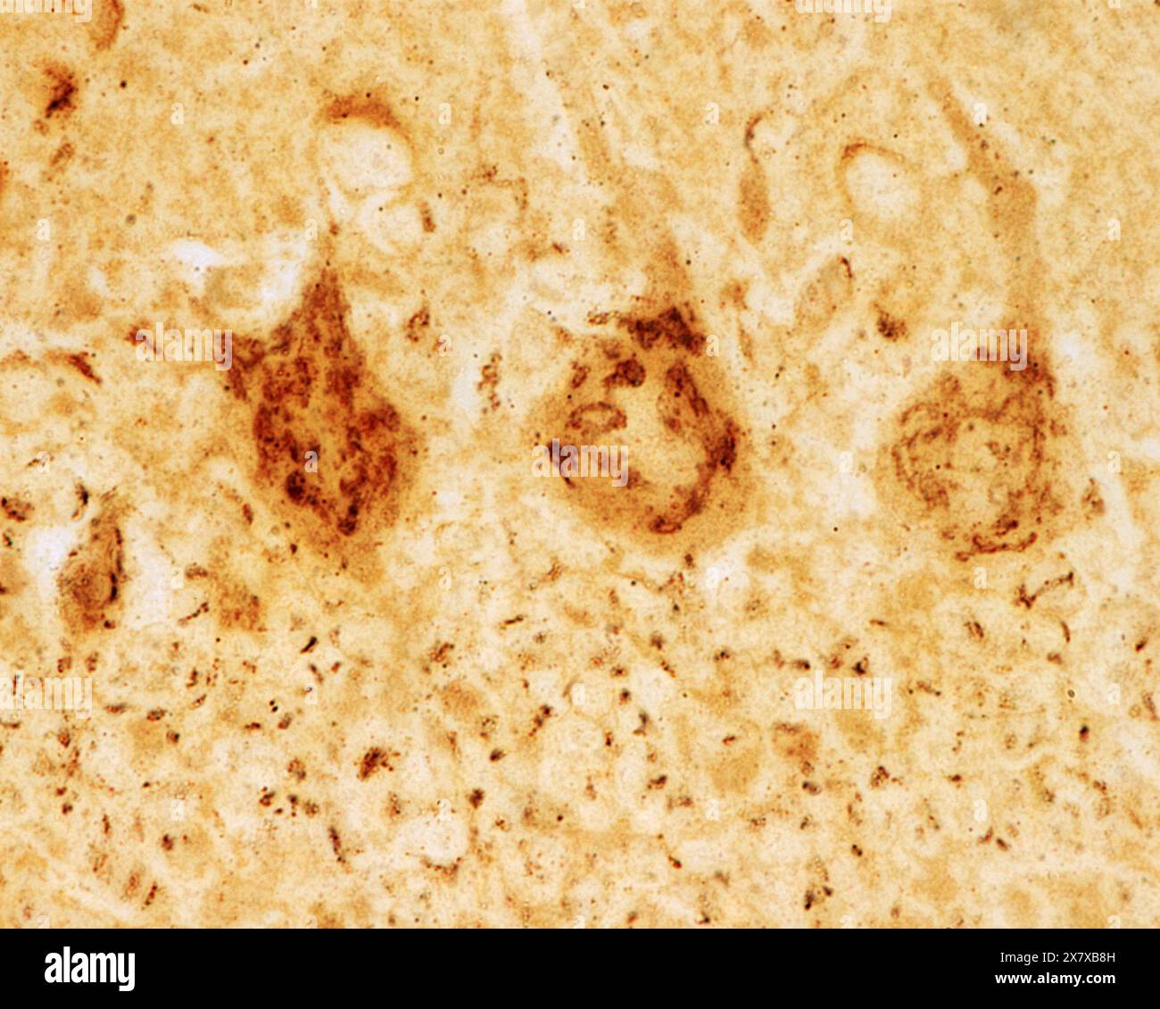 Cerebellar cortex. Light micrograph of Purkinje cells stained with ...