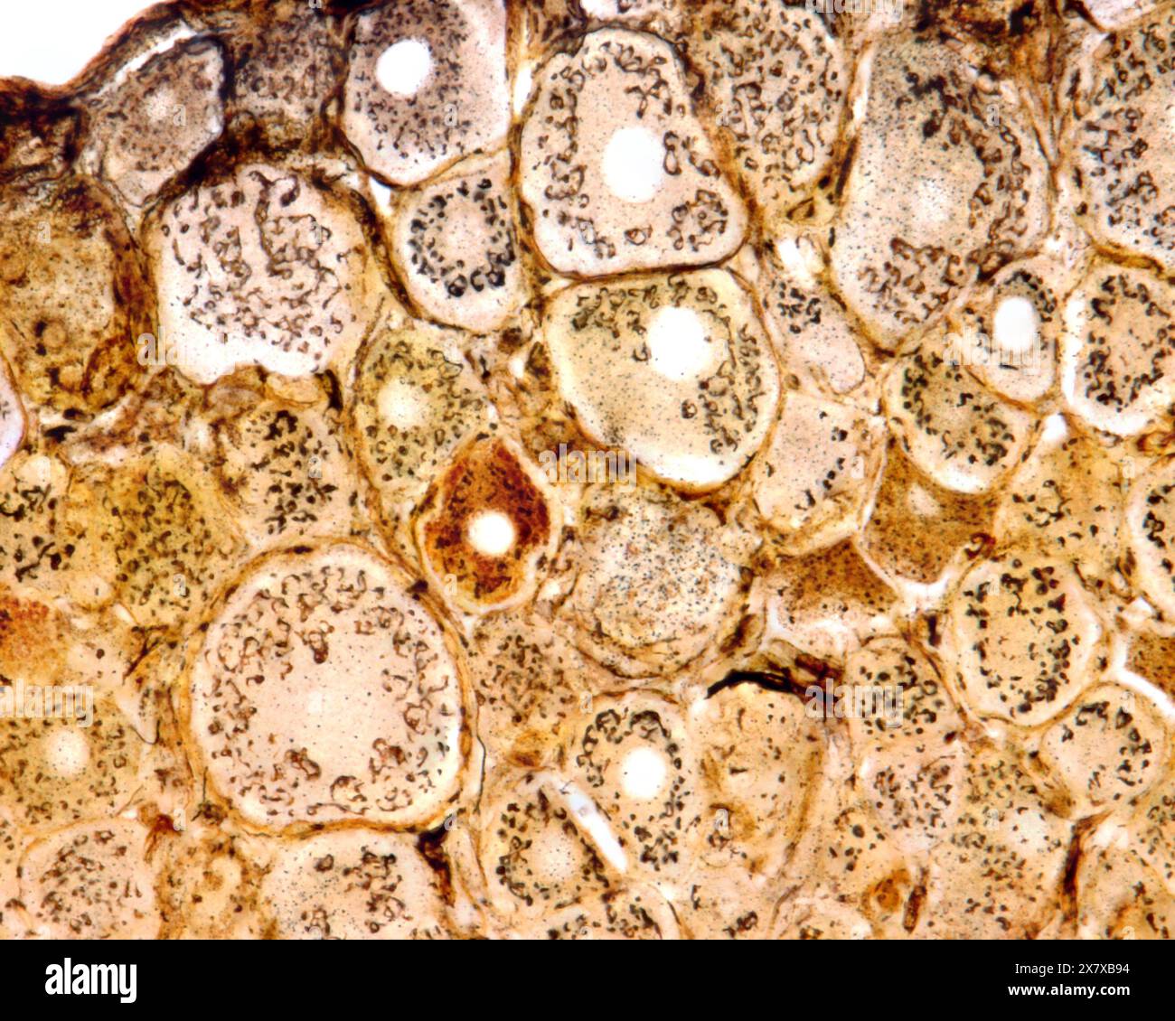 Light micrograph showing Golgi apparatus in neurons (nerve cells) of a ...