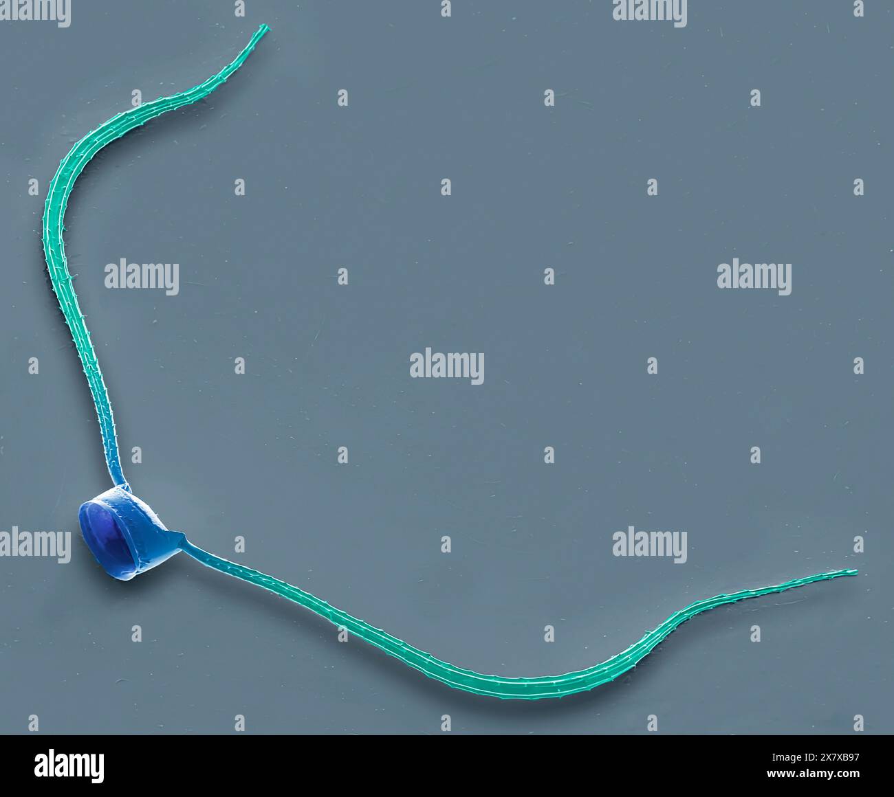 Diatom. Coloured scanning electron micrograph (SEM) of the terminal ...