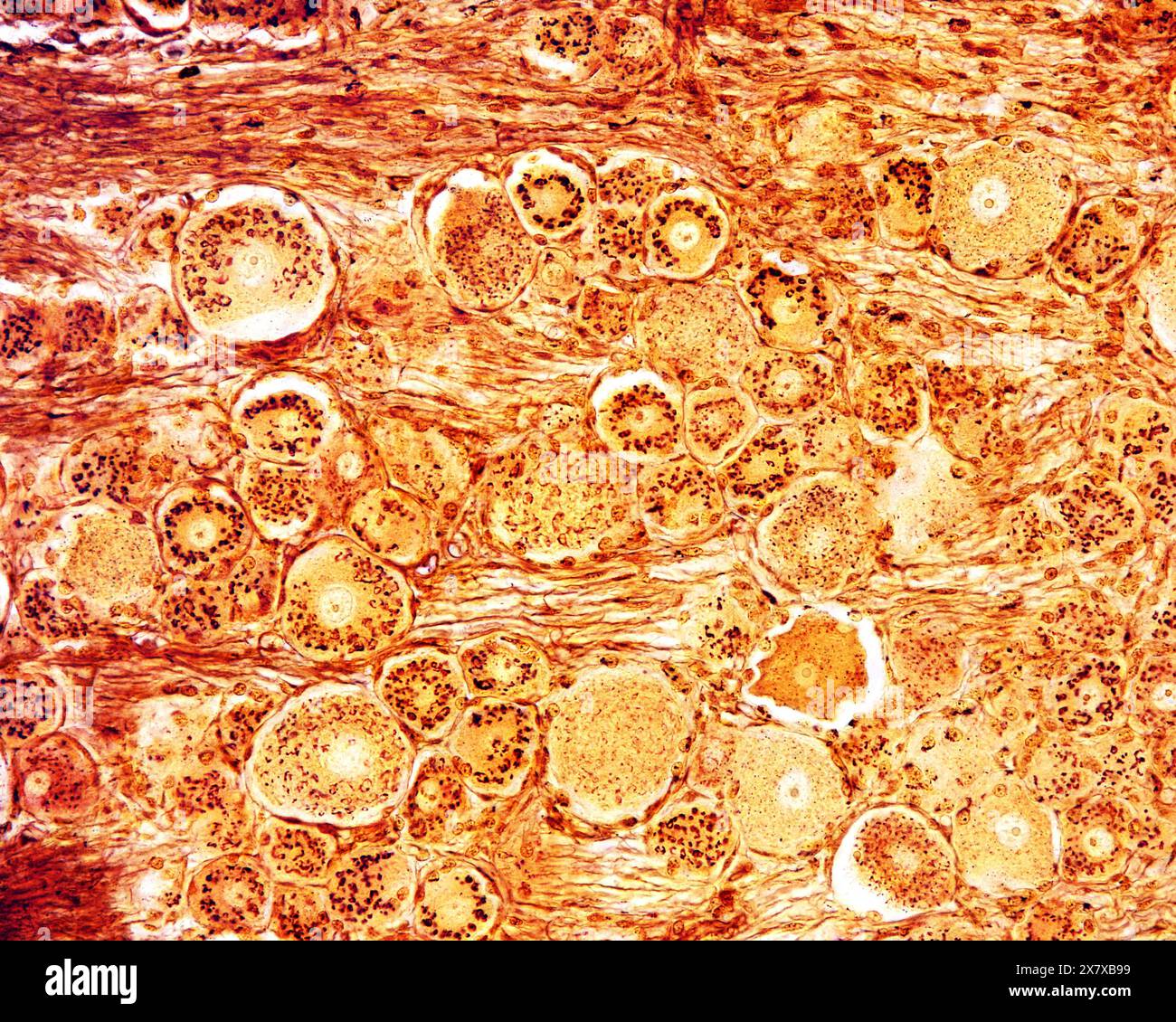 Light micrograph of a dorsal root ganglion stained with Cajal's formol ...