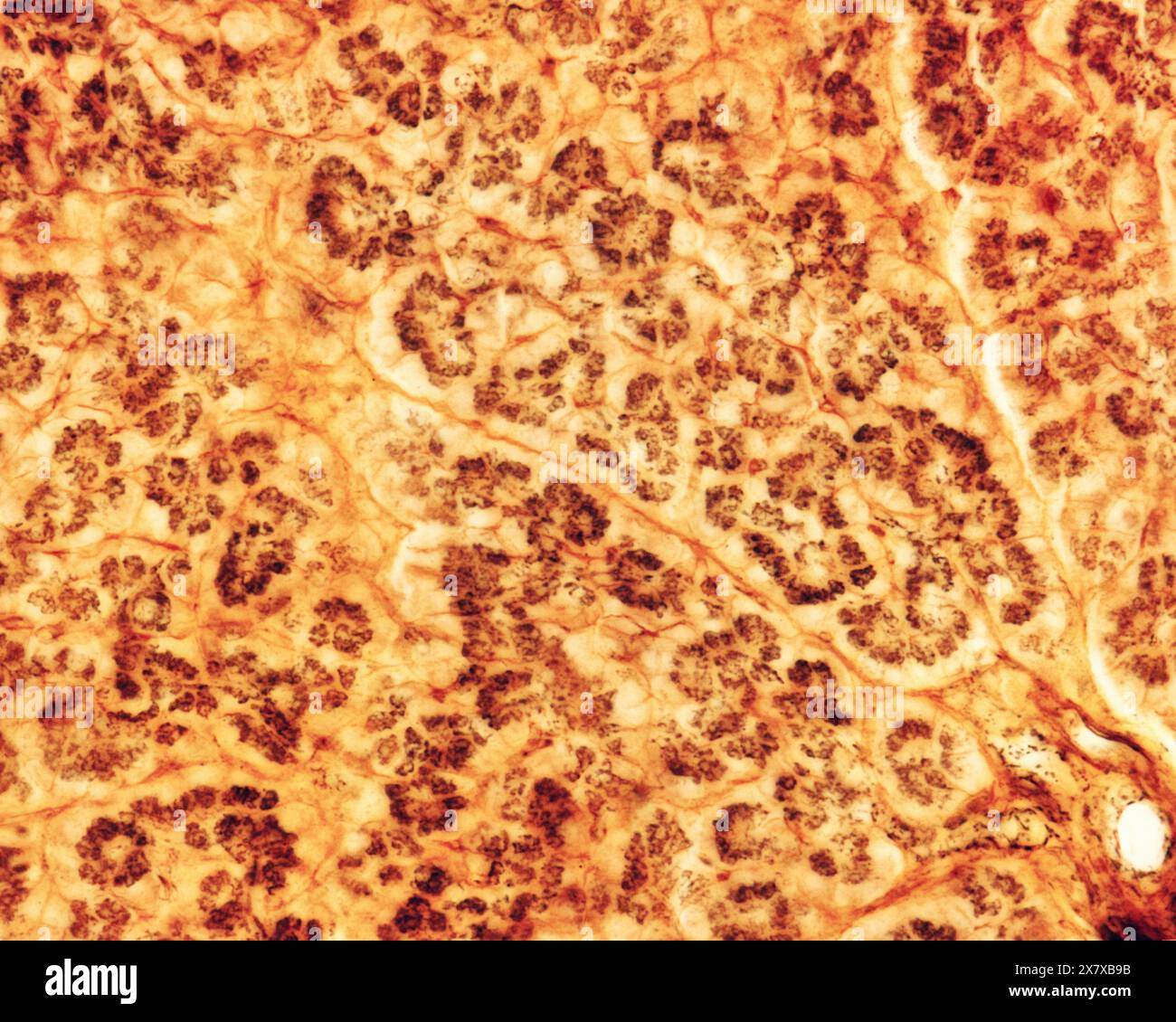 Light micrograph showing the Golgi apparatus in pancreatic acini ...