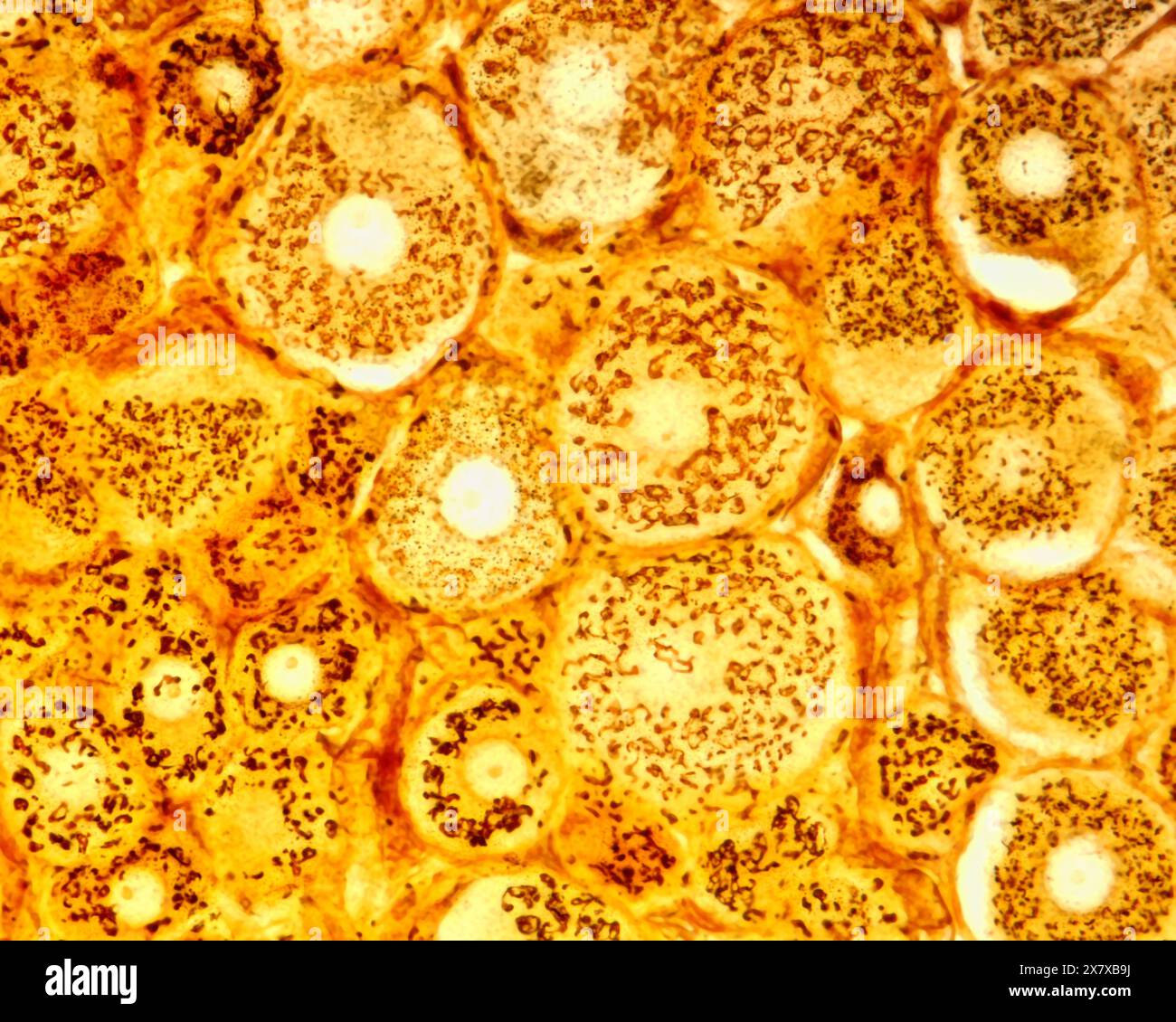 Light micrograph showing Golgi apparatus in neurons (nerve cells) of a ...