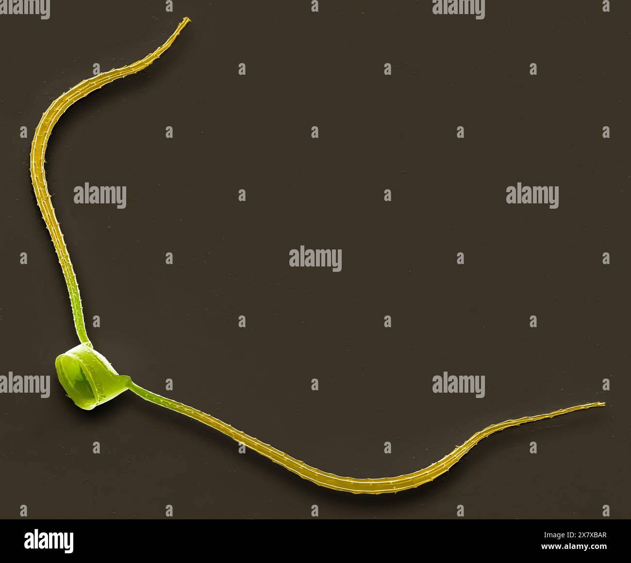 Diatom. Coloured scanning electron micrograph (SEM) of the terminal ...