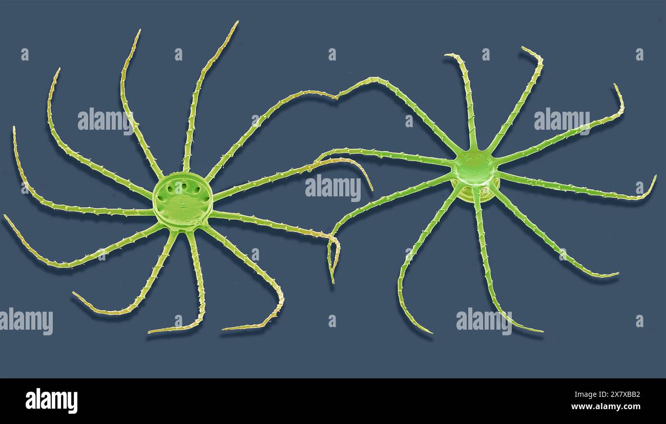Diatoms. Coloured scanning electron micrograph (SEM) of Bacteriastrum ...
