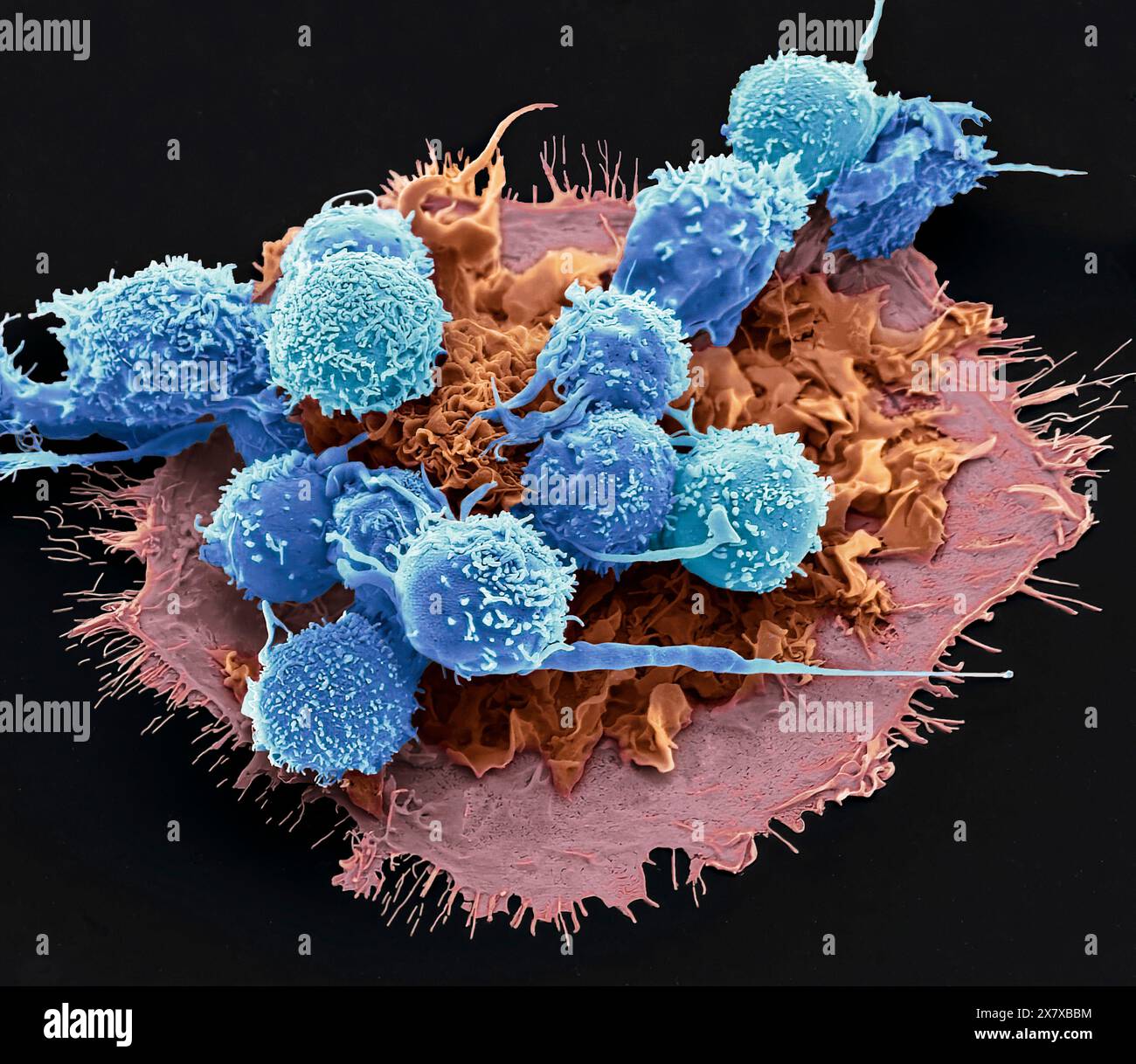 Macrophage and T cells Coloured scanning electron micrograph (SEM ...