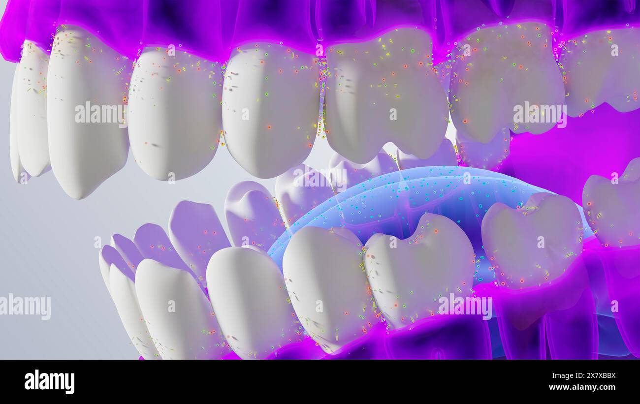 Illustration showing bacteria and virus particles in the mouth, teeth ...