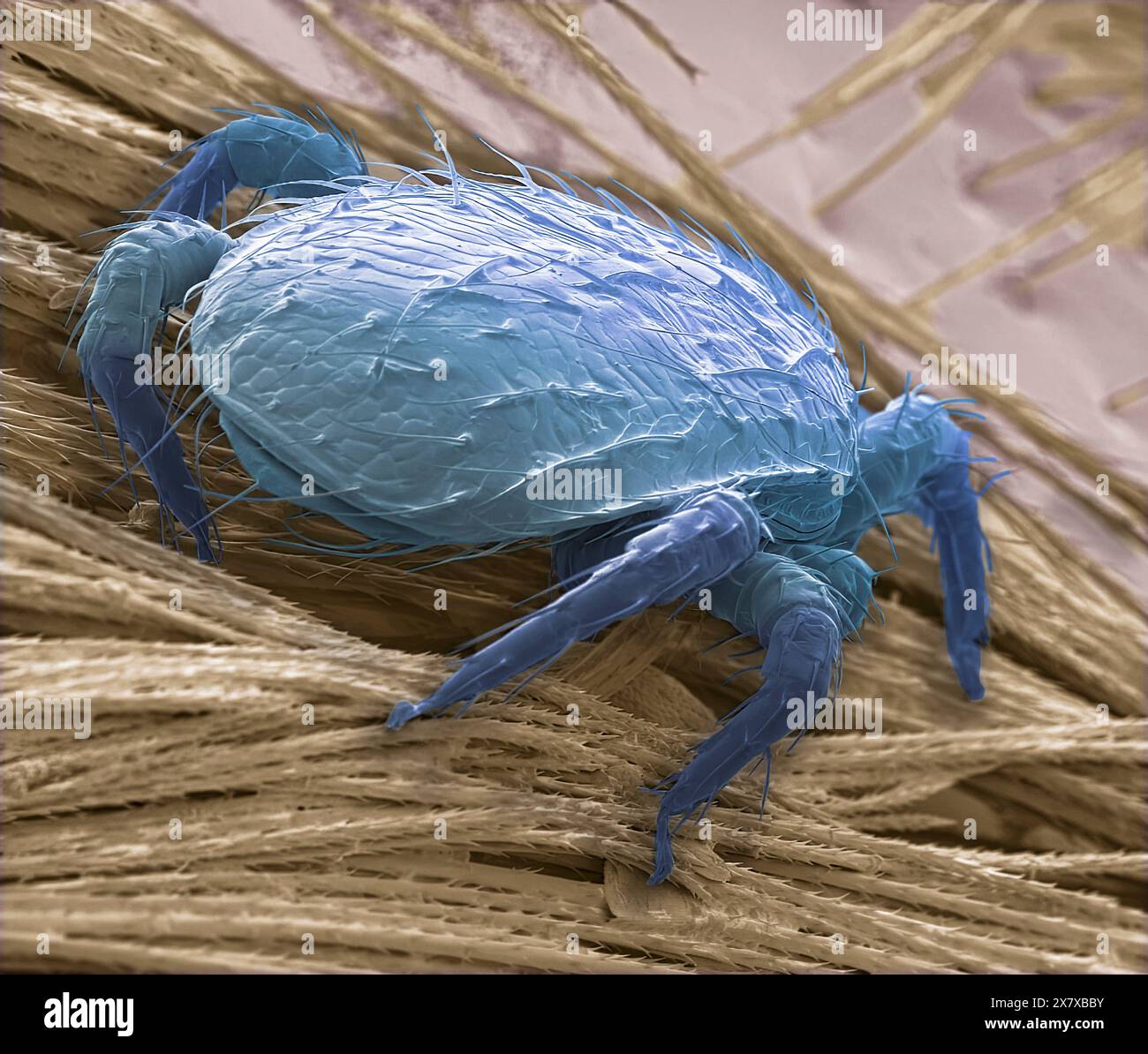 Bumblebee mite. Coloured scanning electron micrograph (SEM) of a bee ...