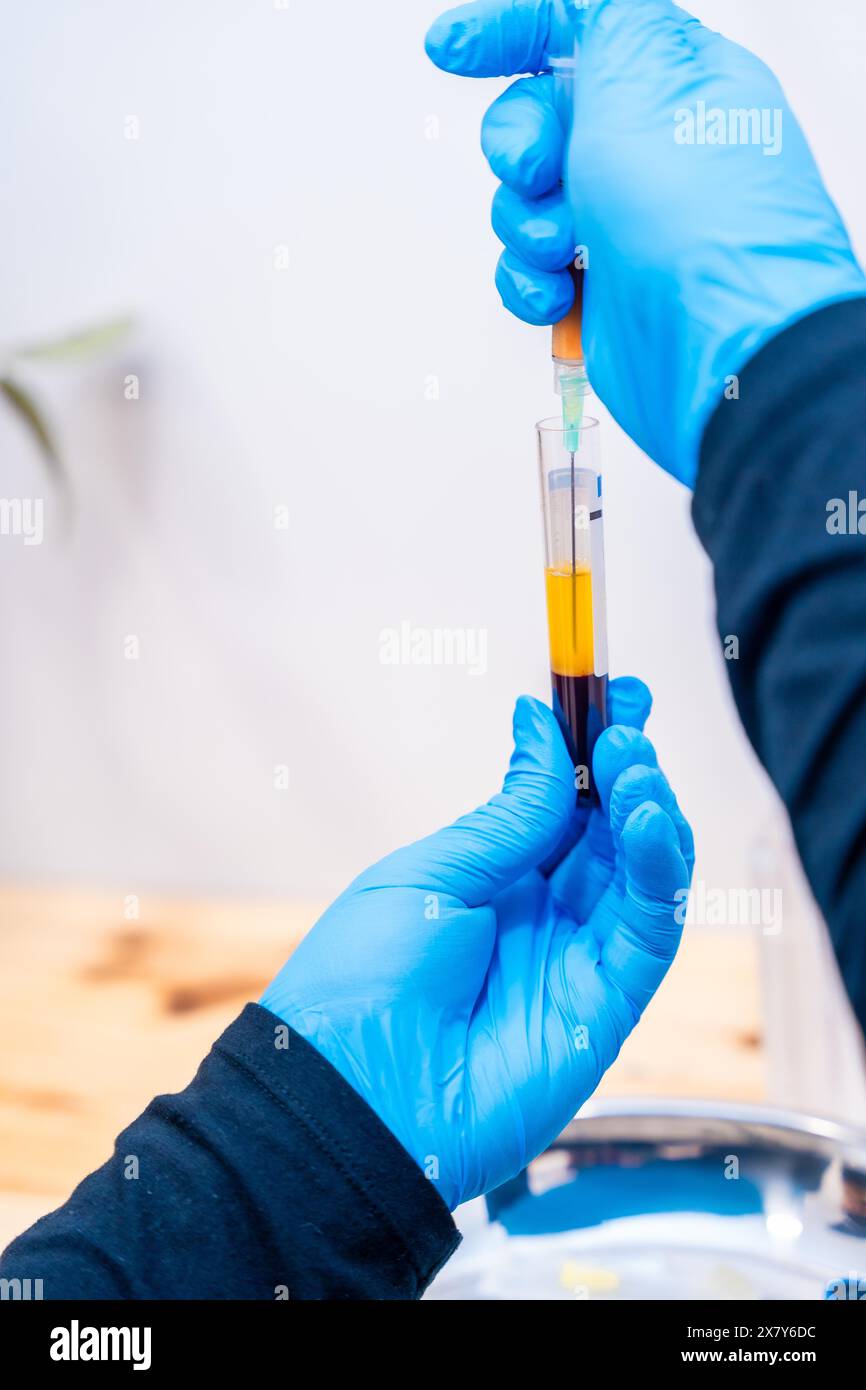 Vertical photo of the hands of a nurse extracting centrifuged blood ...
