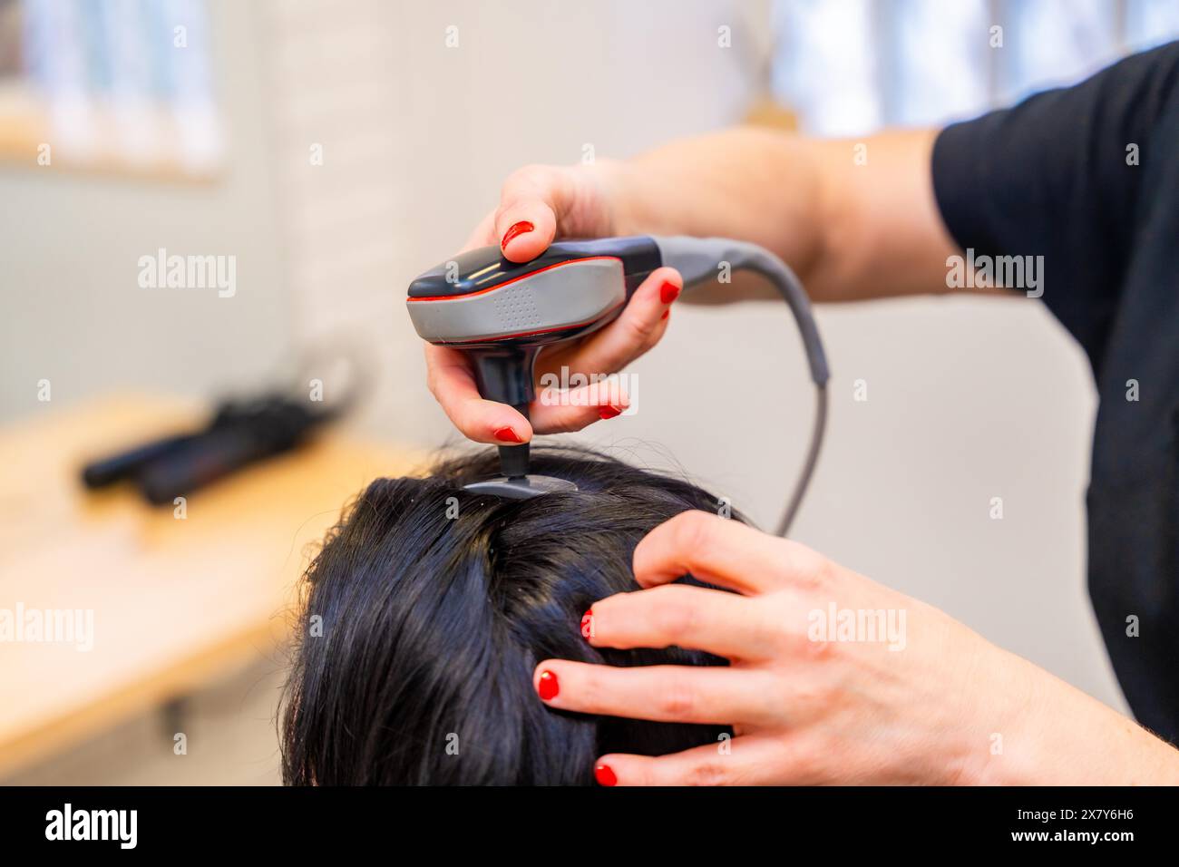 Close-up of a Woman receiving hair loss treatment at capillary clinic ...