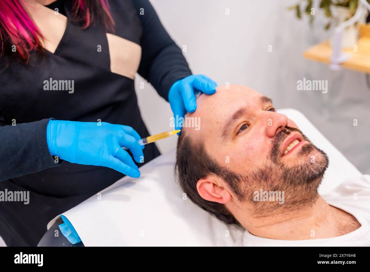 Man receiving a mesotherapy treatment for Hair Loss injecting blood in ...