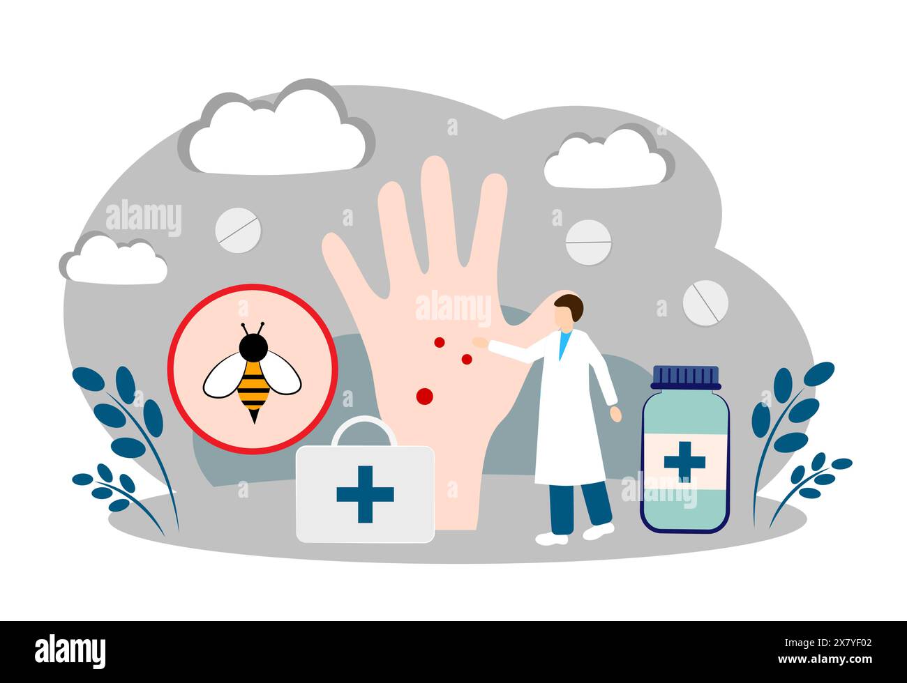 Bee sting. Insect bites. Medicine. Human anatomy. Doctor Stock Vector ...