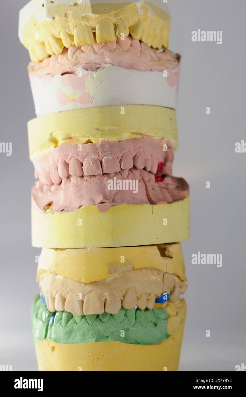 Impression Mold of Teeth Stock Photo - Alamy