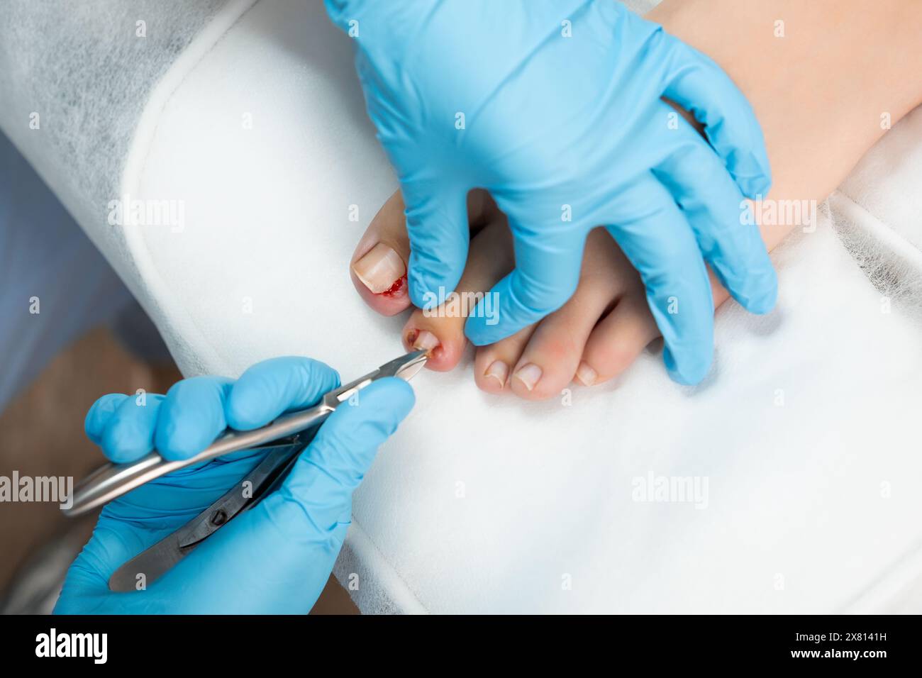 Professional medical pedicure using special nail instruments in the ...